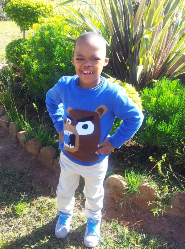 Dx Trisomy 21: Pepe's Success Story - Institutes