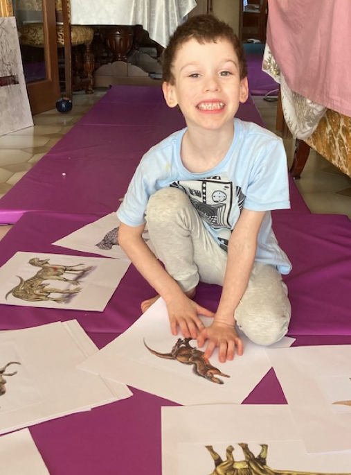 Dx Global Developmental Delay, Mental Deficiency & Autism: Matthew ...